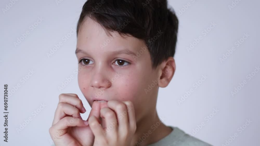 Vidéo Stock A boy puts on retainers, on a white background. Concept of ...