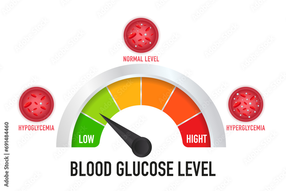 Blood Glucose Levels scale. Normal level. Hyperglycemia, High Blood ...