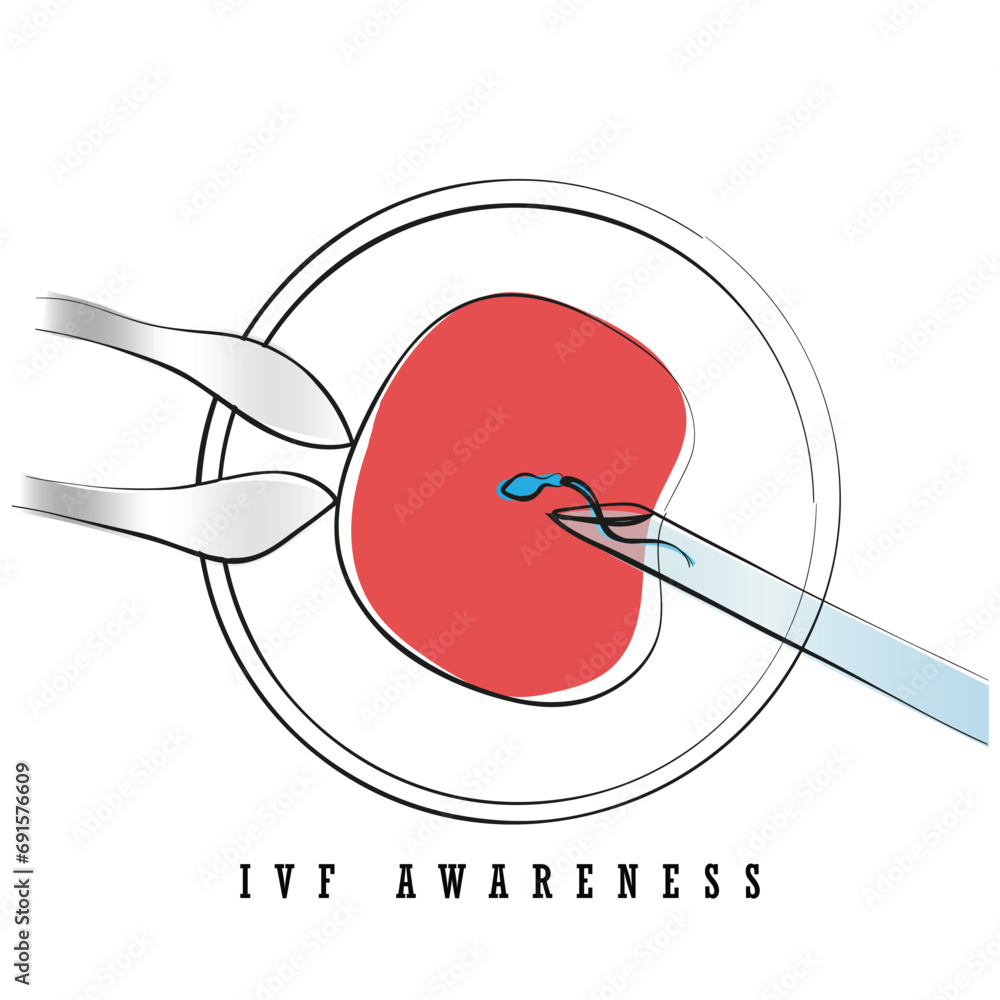 hand drawn line art vector of Artificial Insemination. IVF miracle ...
