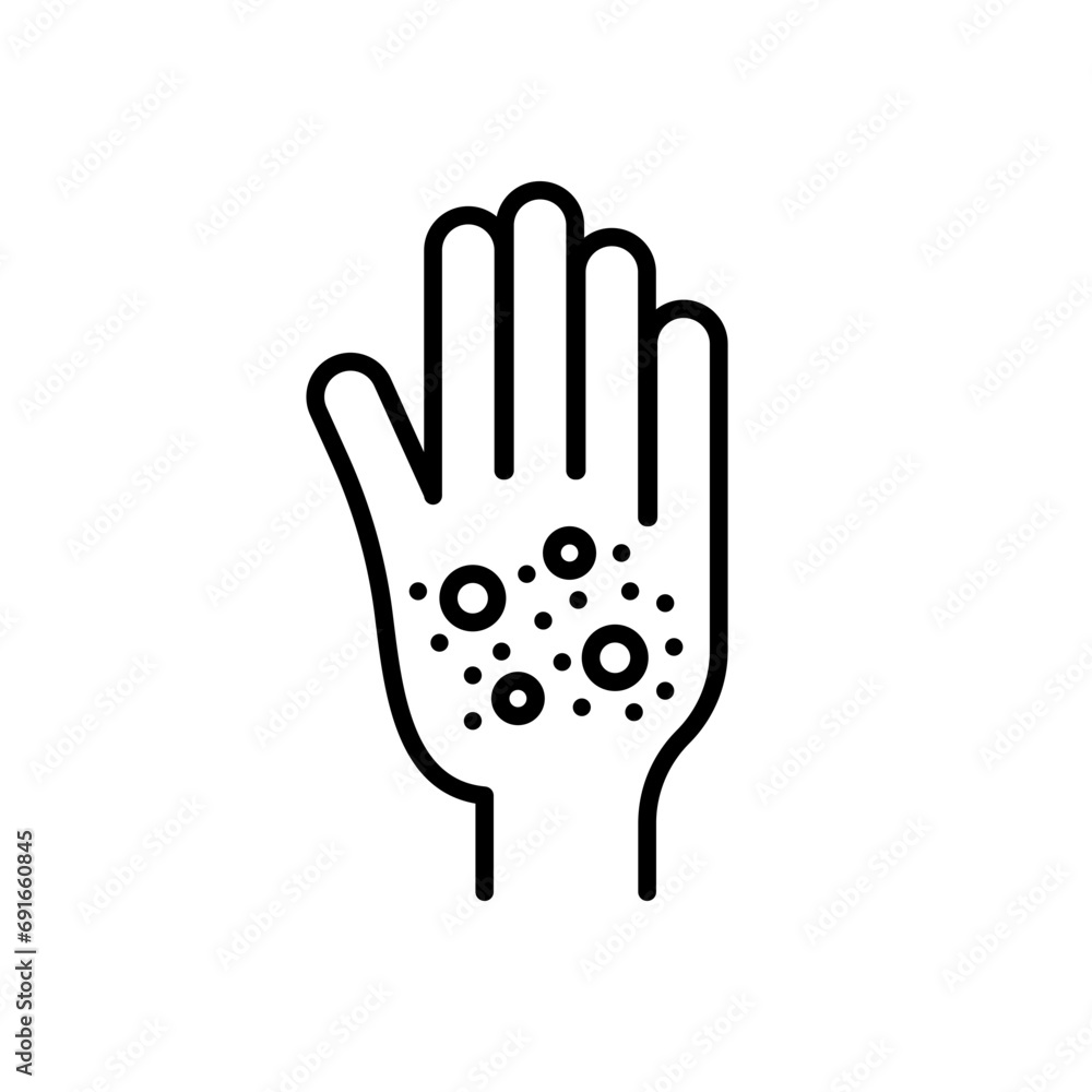 Rash hand icon. chickenpox hand palm with redness acne pimple rash burn ...
