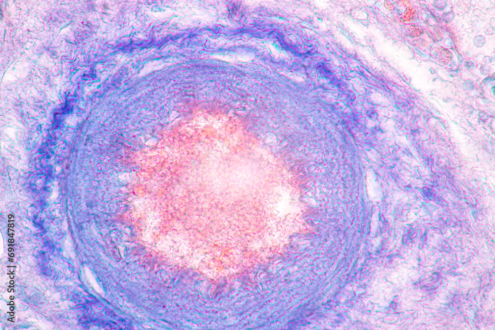 Anatomy and Histological Rea Bone marrow Human, Hyaline cartilage human ...