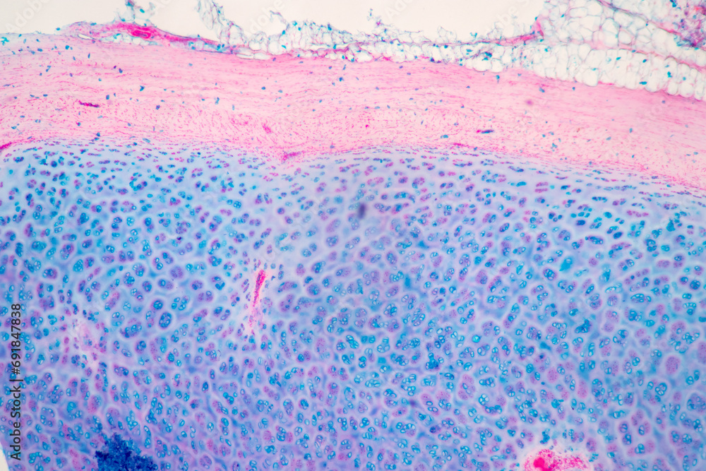 Anatomy and Histological Rea Bone marrow Human, Hyaline cartilage human ...