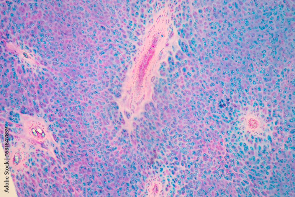 Anatomy and Histological Rea Bone marrow Human, Hyaline cartilage human ...