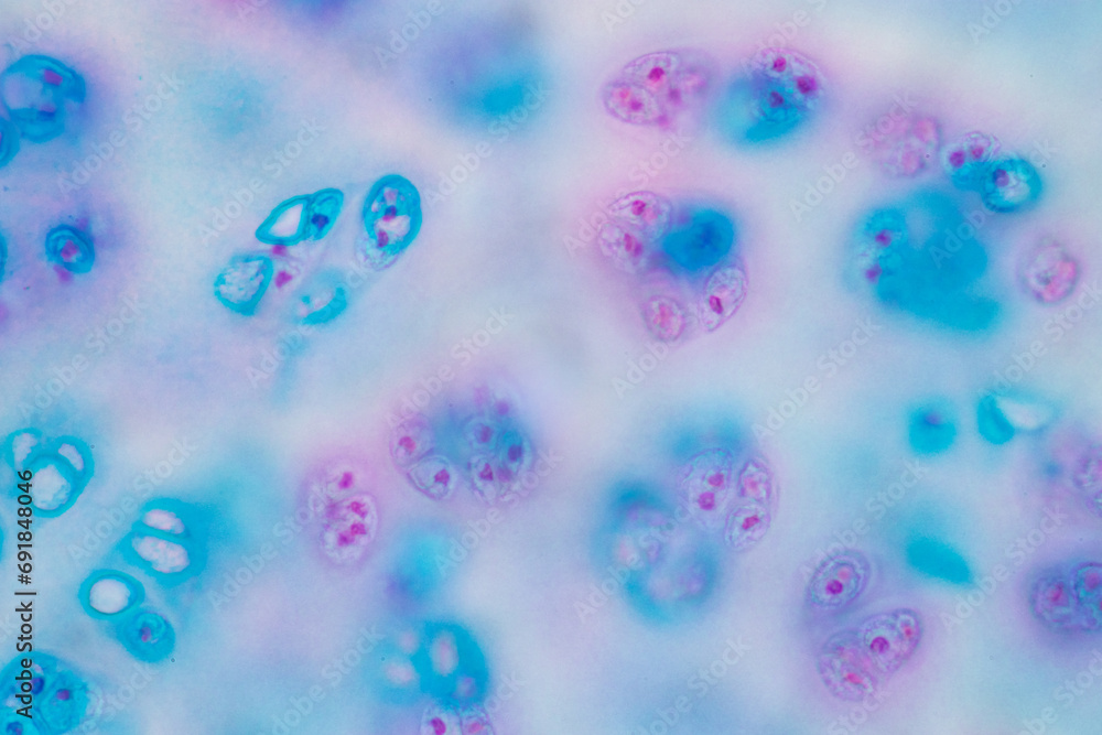 Anatomy and Histological Rea Bone marrow Human, Hyaline cartilage human ...
