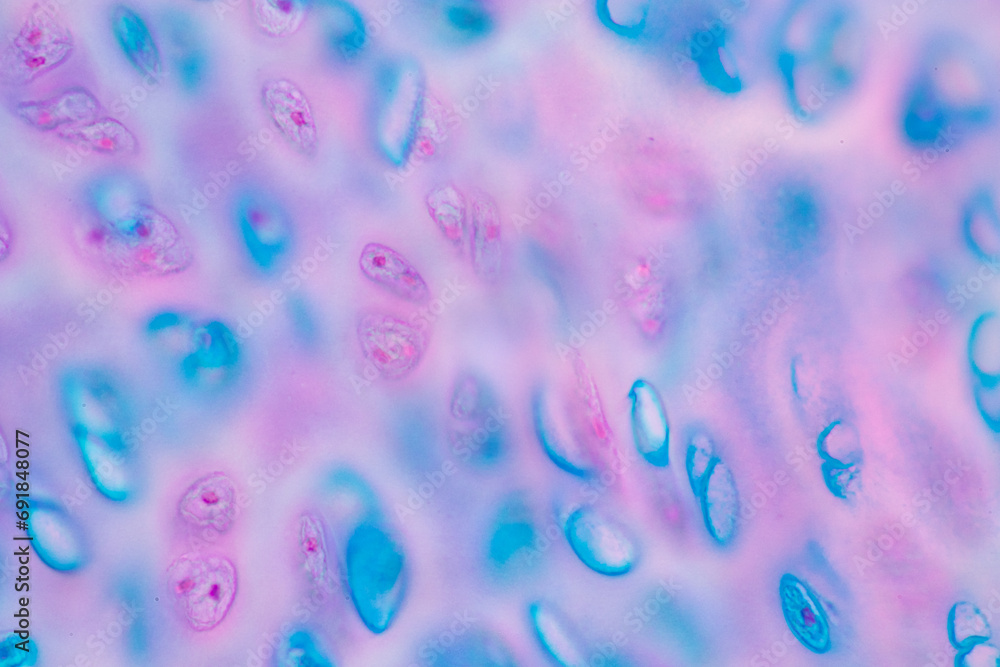 Anatomy and Histological Rea Bone marrow Human, Hyaline cartilage human ...