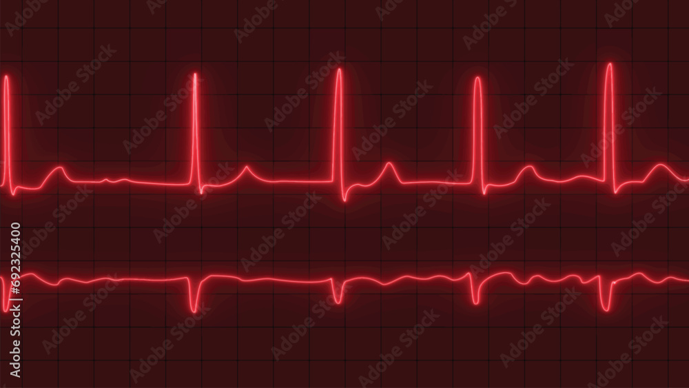 Atrial fibrillation vector. ECG or EKG pulse heartbeat red line ...