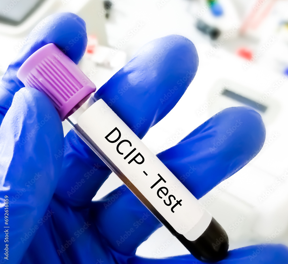 Bood sample tube for DCIP (dichlorophenol indophenol precipitation ...