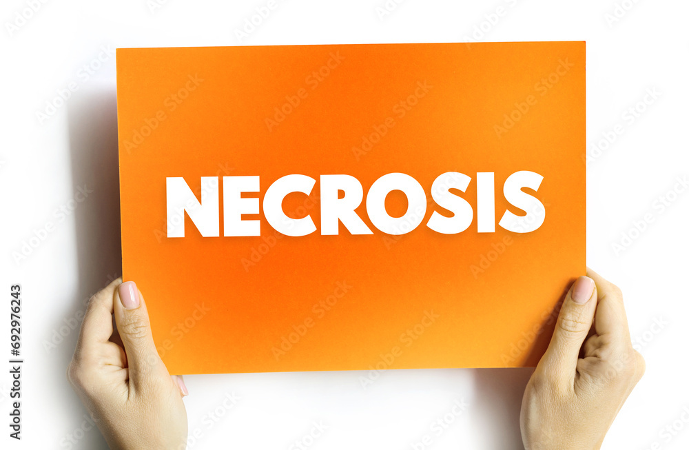 Necrosis is the death of body tissue, text concept on card for ...