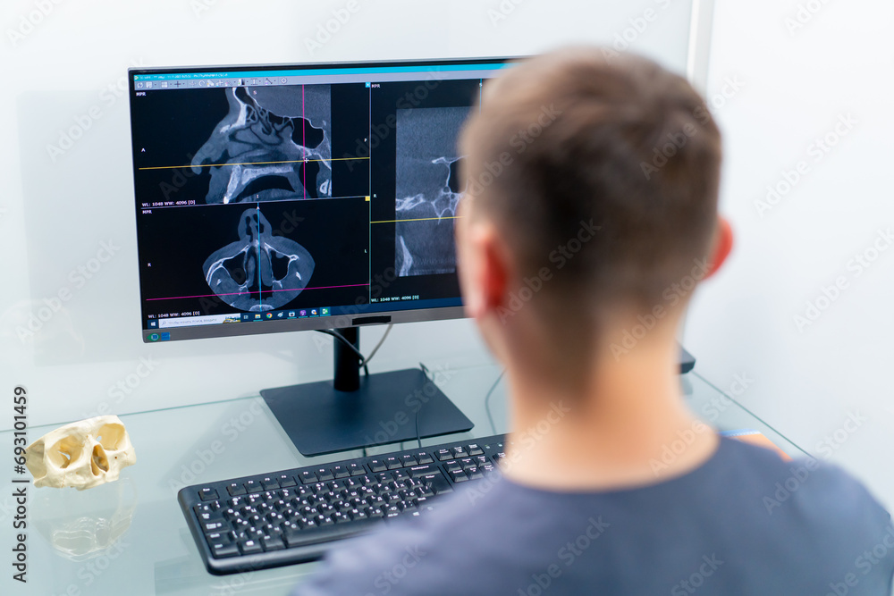 a radiologist doctor looks at a screen showing a 3D image of a nose ...