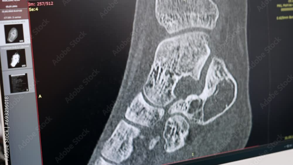 Checking the bone mri scan of a patient before the operation. X-ray ...