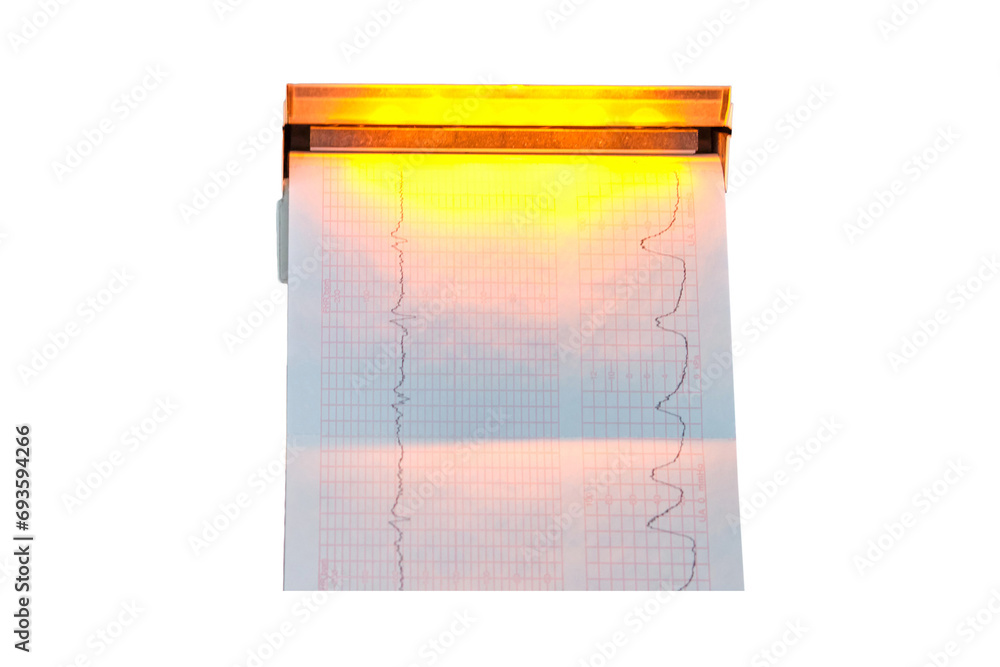 CTG device with monitoring of the state of health of the mother and ...