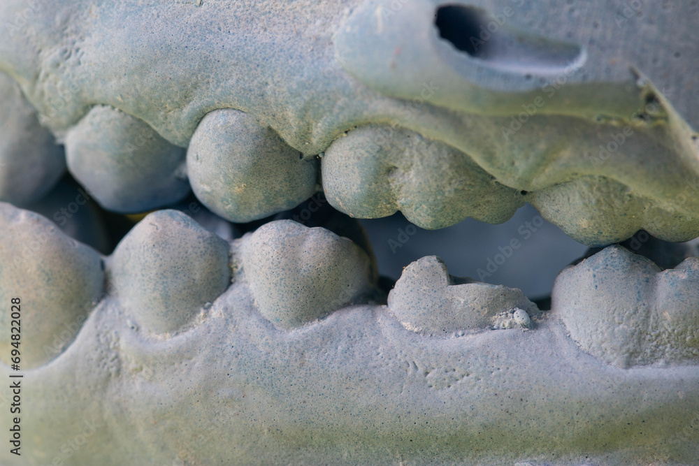 Blue plaster impression of the dental jaw of a patient with crooked ...
