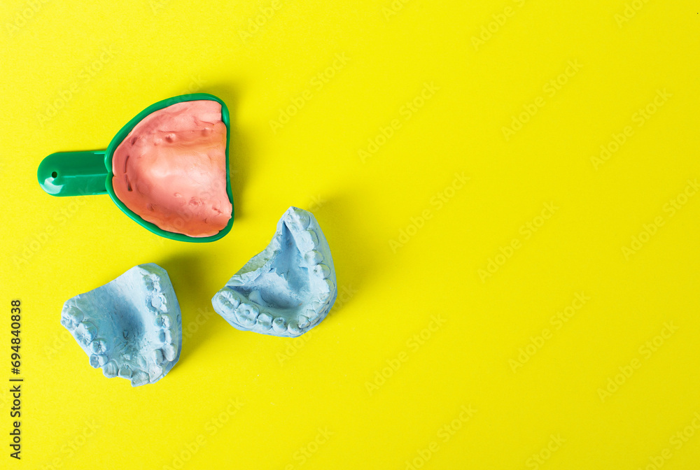 Blue plaster cast of a dental jaw and a dental tray for an impression ...