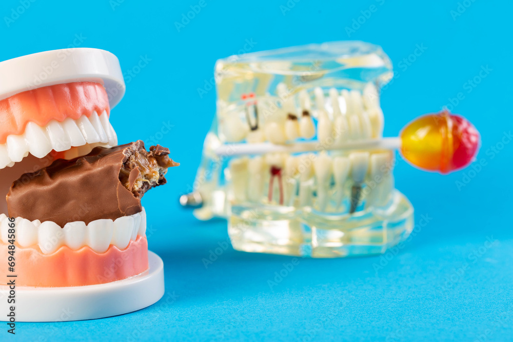 Two mock-ups of dental jaws with a lollipop and a chocolate bar on a ...