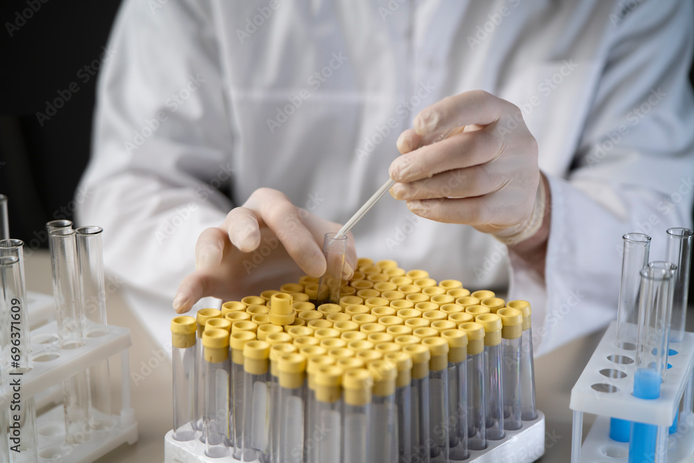 pure water test, drop liquid sample from pipette to the test tube in ...