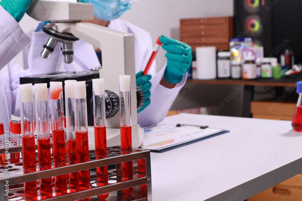 Researcher hand holding a blood vessel Vascular examination in a ...