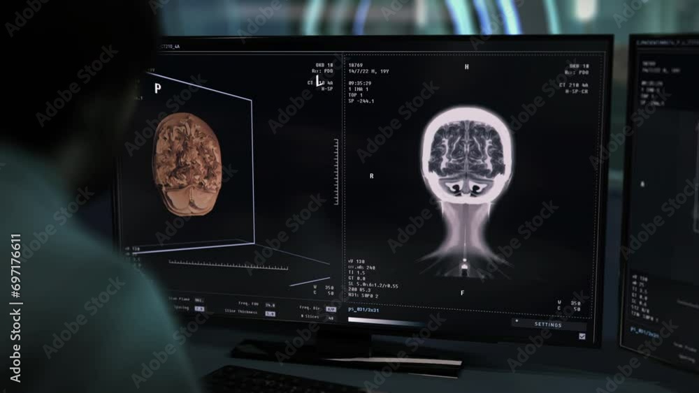 X-ray scanner analysing the skull of the hospital patient. X-ray ...