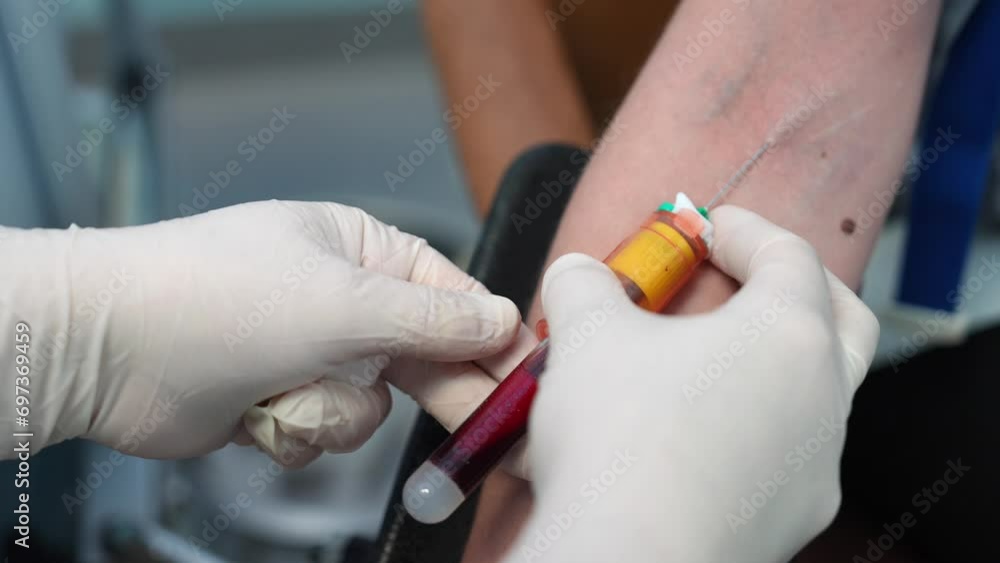 Laboratory assistant taking blood with vacuum capsule for test from the ...
