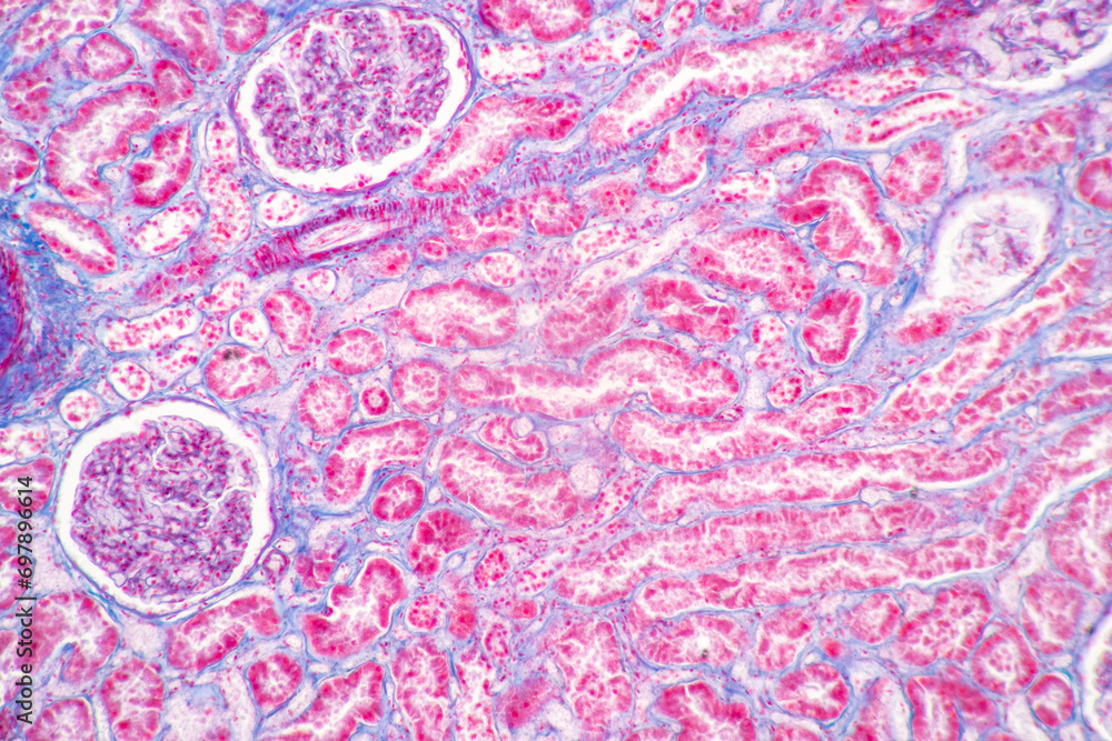 Structure of Tissue of Spleen Human, Liver Human and Kidney Human under ...