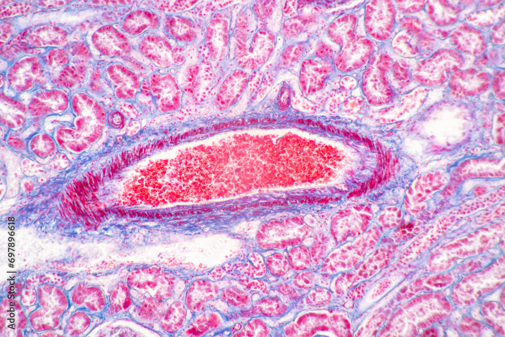 Structure of Tissue of Spleen Human, Liver Human and Kidney Human under ...