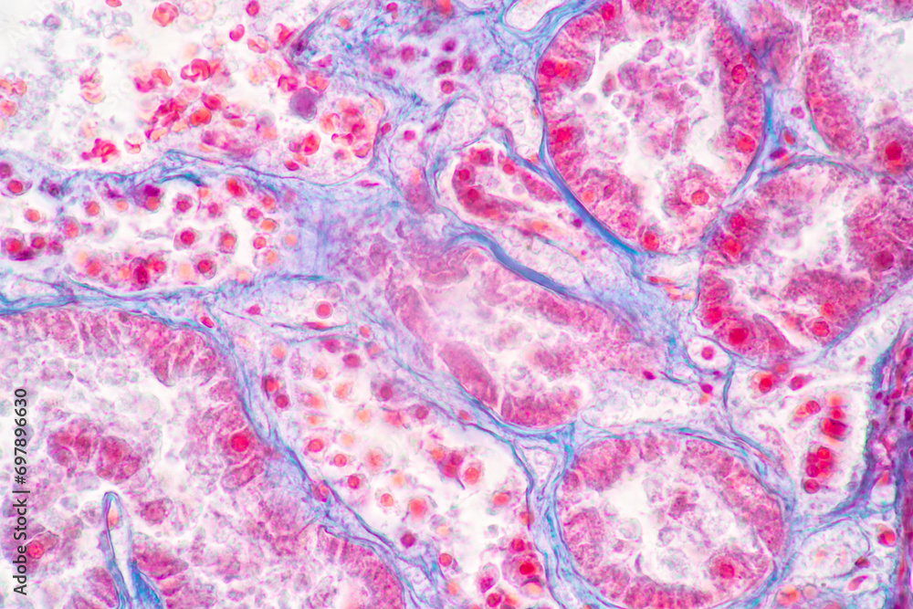 Structure of Tissue of Spleen Human, Liver Human and Kidney Human under ...
