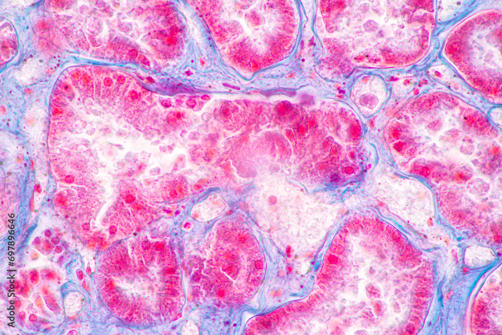 Structure of Tissue of Spleen Human, Liver Human and Kidney Human under ...