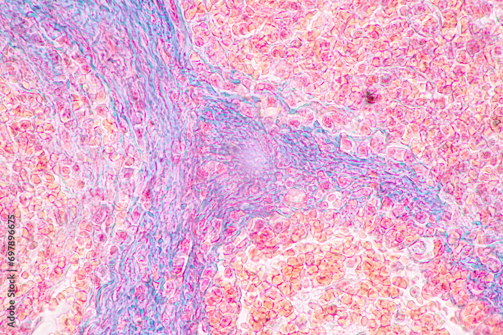 Structure of Tissue of Spleen Human, Liver Human and Kidney Human under ...