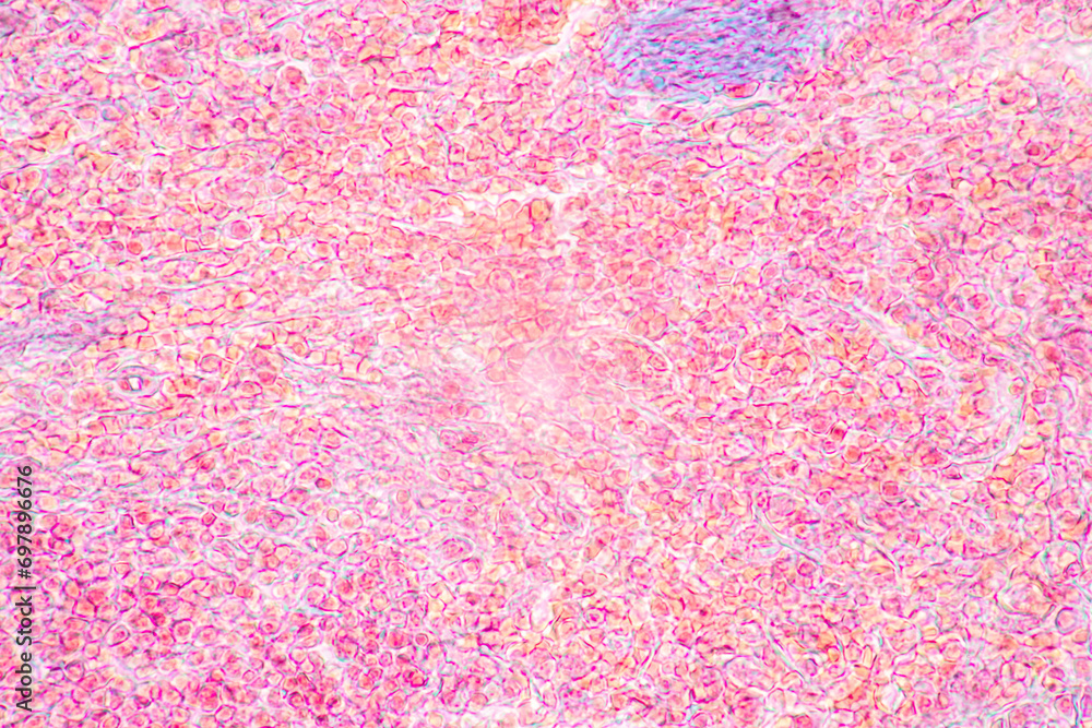 Structure of Tissue of Spleen Human, Liver Human and Kidney Human under ...
