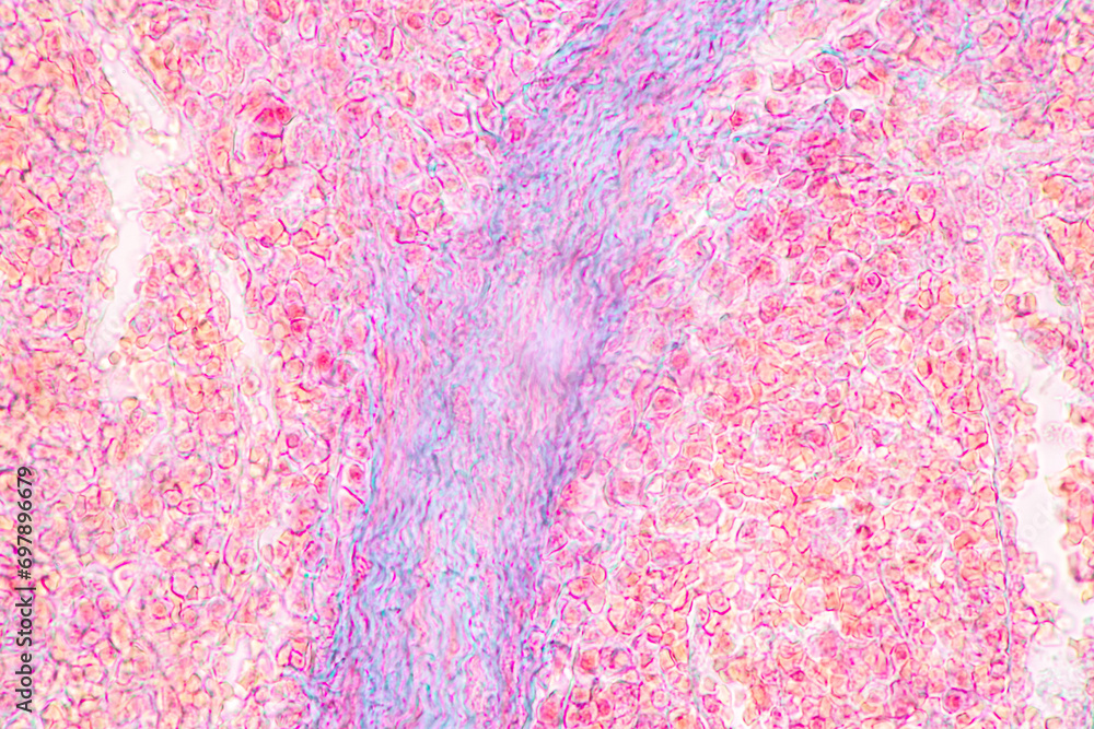 Structure of Tissue of Spleen Human, Liver Human and Kidney Human under ...