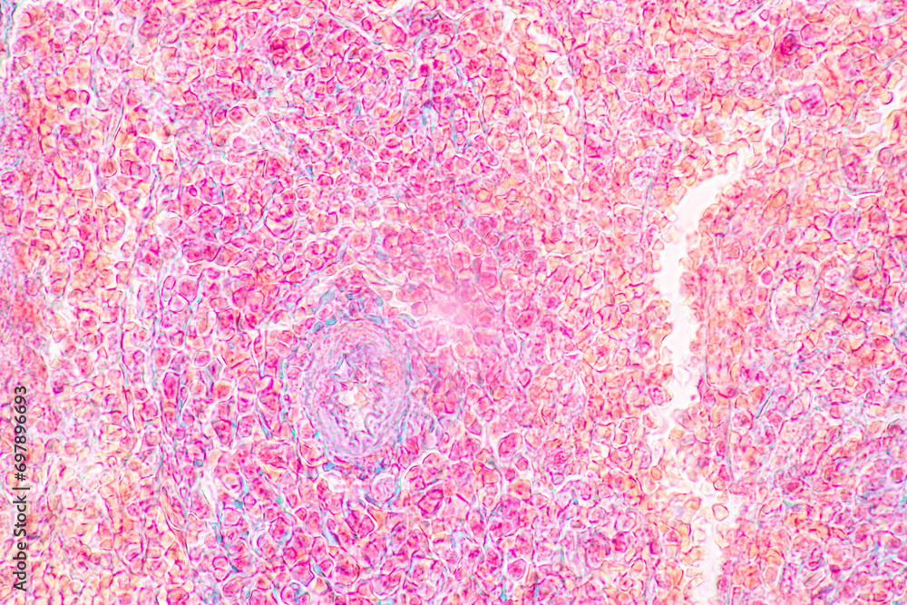 Structure of Tissue of Spleen Human, Liver Human and Kidney Human under ...