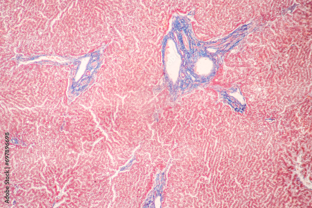 Structure of Tissue of Spleen Human, Liver Human and Kidney Human under ...
