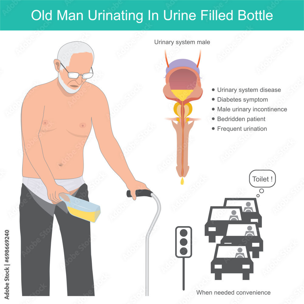 Old man urinating in urine filled bottle. old man urinating in urine ...