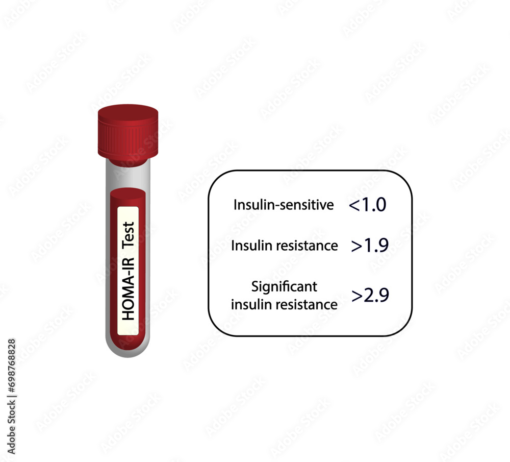 HOMA-IR (Homeostatic Model Assessment for Insulin Resistance).Low ...
