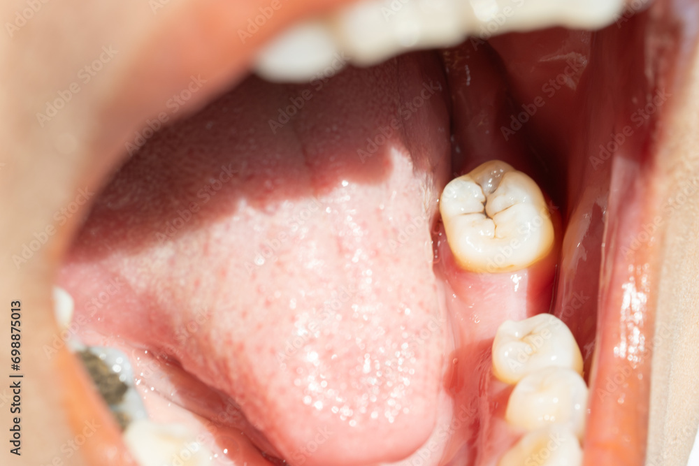 Tooth's a woman smoking bad. man smokes a cigarettes have tooth decay ...