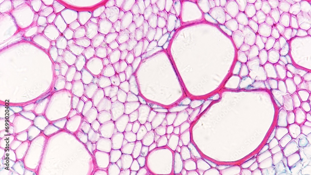 Xylem tissue of sunflower (Helianthus sp) root. Cross section of dicot ...