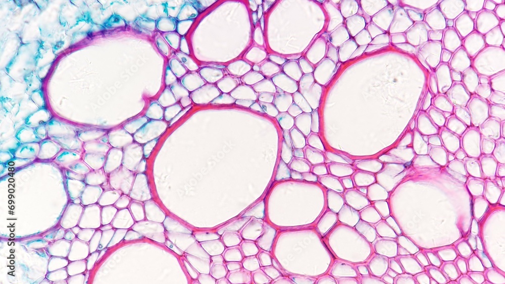 Xylem tissue of sunflower (Helianthus sp) root. Cross section of dicot ...