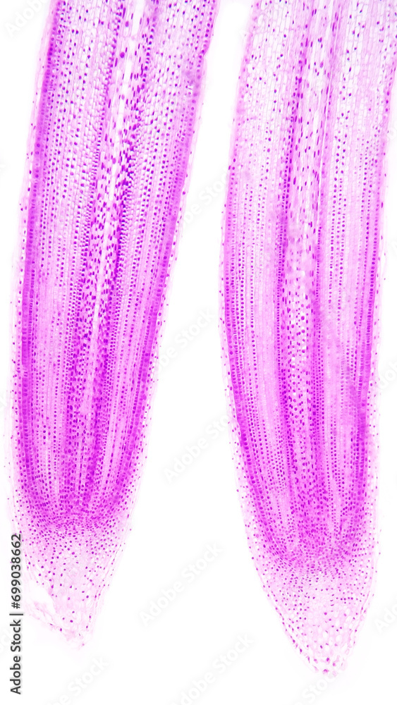 Longitudinal section of Allium sp root. Monocot root longitudinal ...