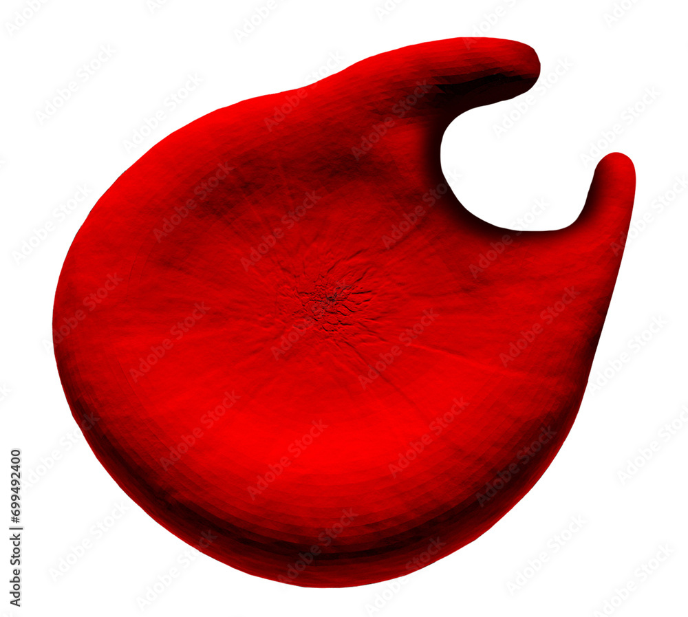 Horn cell abnormal red blood cell, illustration Stock Illustration ...