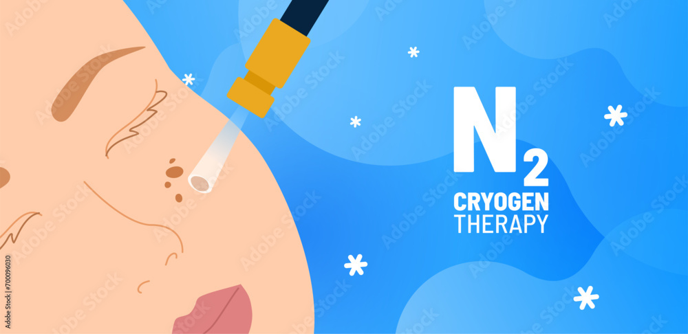 Cryotherapy process vector illustration. Removing age spots on woman's ...