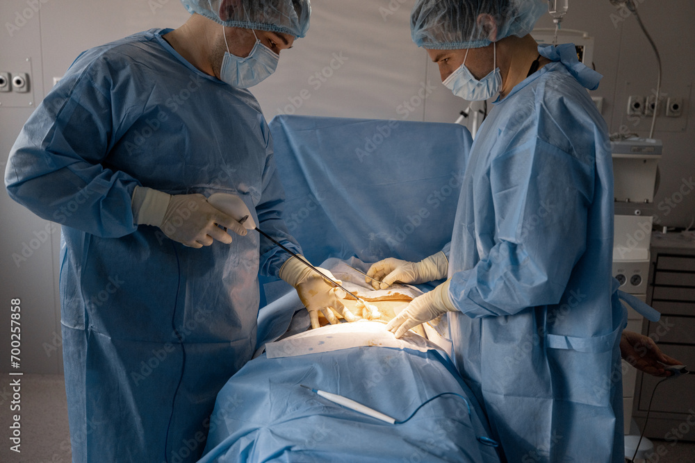 Two surgeons operates abdominal area of a patient. Concept of real ...