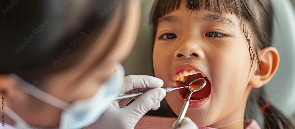 Dental kid health examination Doctor examines oral cavity of little child uses mouth mirror to ...