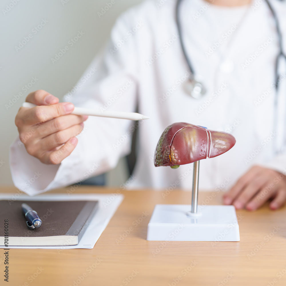 Doctor with human Liver anatomy model. Liver cancer and Tumor, Jaundice ...