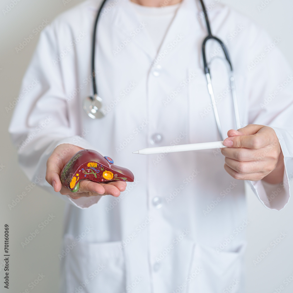 Doctor holding human Liver anatomy model. Liver cancer and Tumor ...