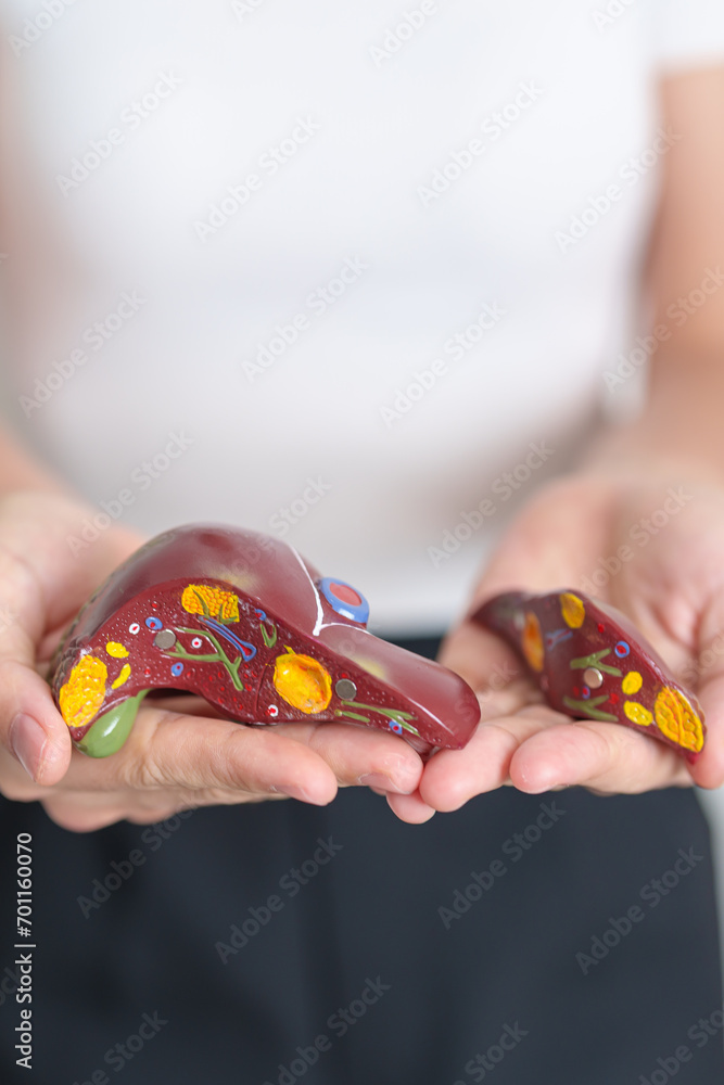 Woman holding human Liver anatomy model. Liver cancer and Tumor ...