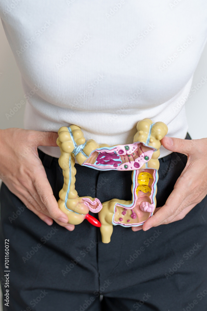 Woman holding human Colon anatomy model. Colonic disease, Large ...