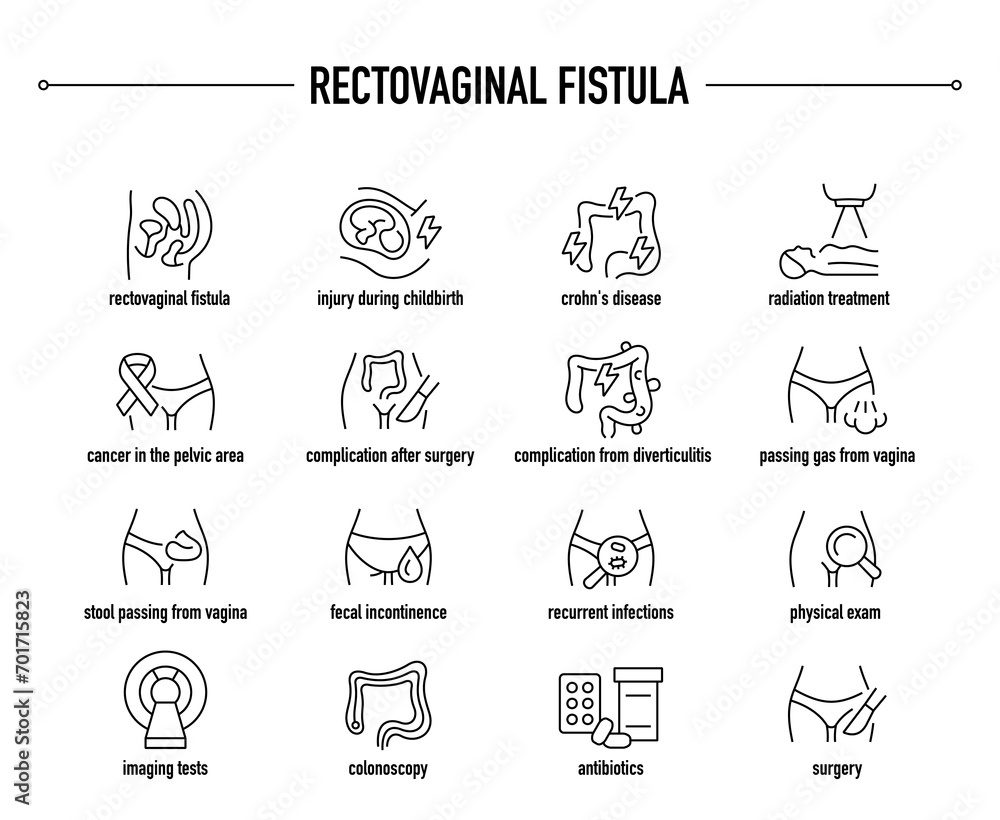Rectovaginal Fistula symptoms, diagnostic and treatment vector icons. Line editable medical ...