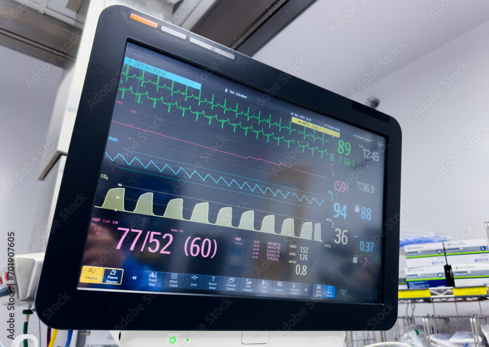Hospital monitor displays vital signs, healthcare concept, medical ...