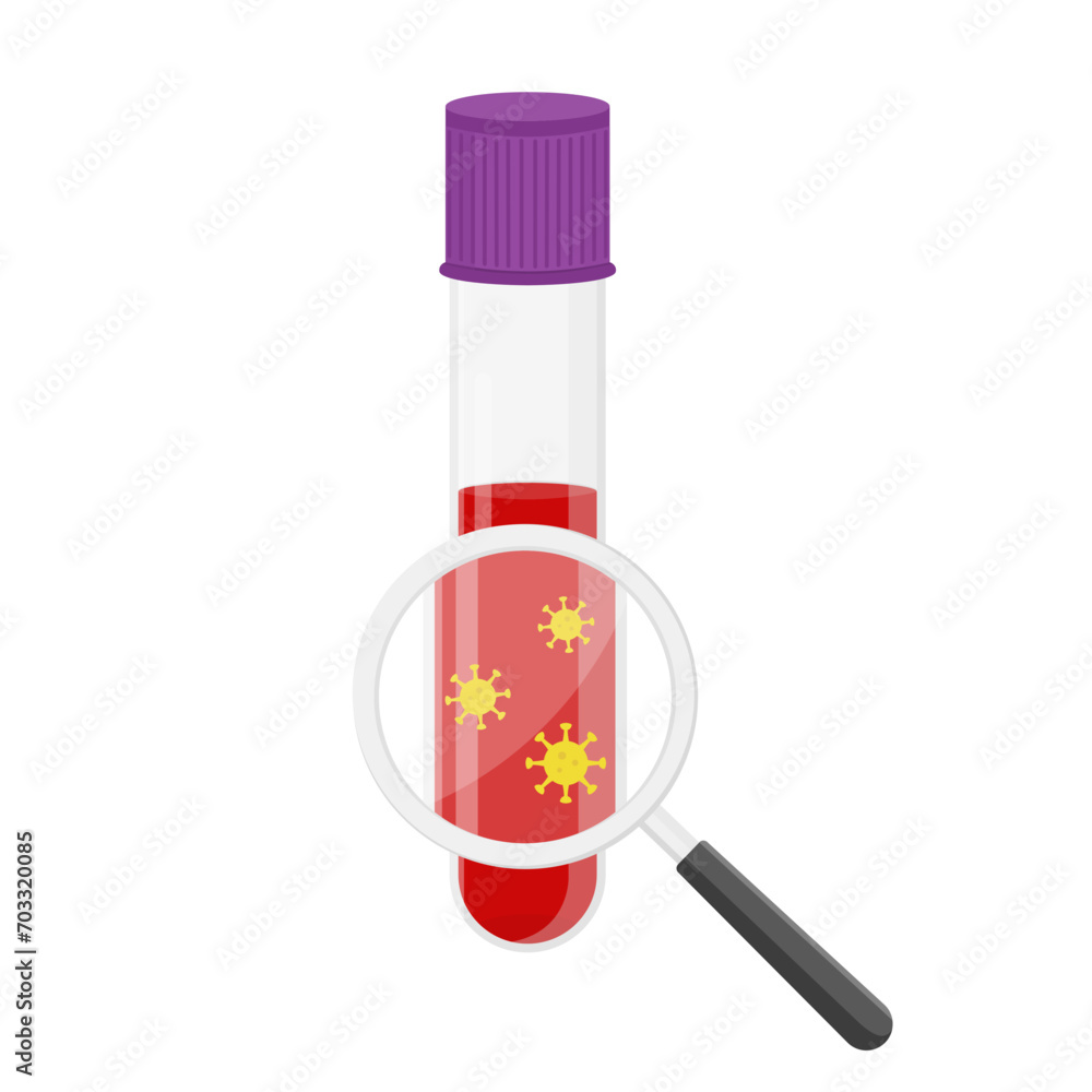 COVID-19 test, Positive Test Results Form. Tubes with blood sample, and ...