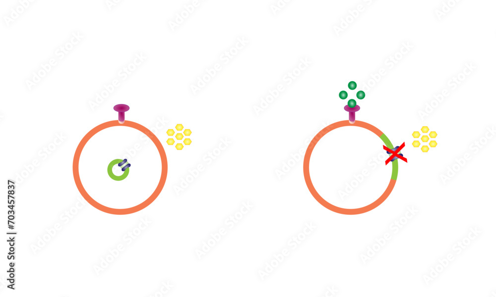Diabetes mellitus type 1, pancreas's failure to produce enough insulin ...