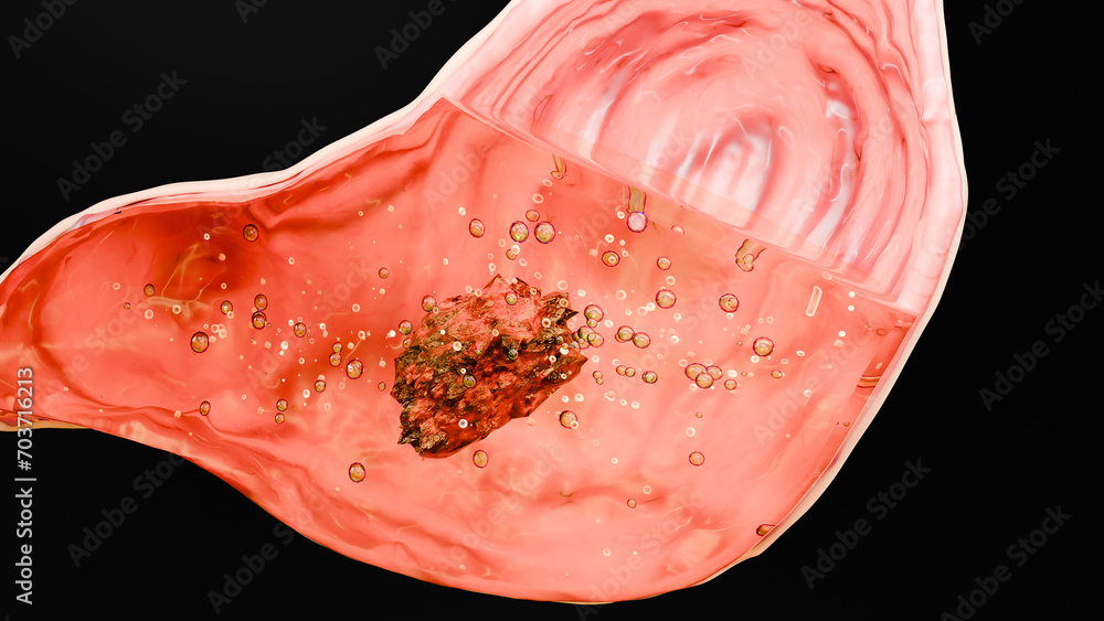 Human Stomach Anatomy Digestion, esophagus abdomen gastric with acid ...